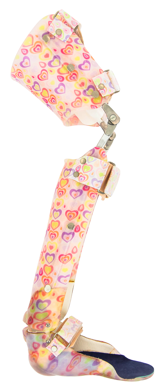 Custom Lower Extremity Orthoses - Orthopedic Bracing Solutions Inc